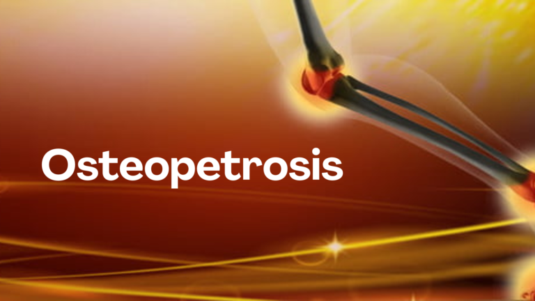 Osteopetrosis - Maruthuva Valam